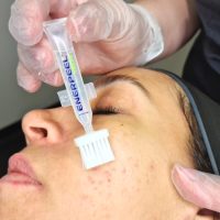 FACIAL SKIN TREATMENTS – Skin Revival